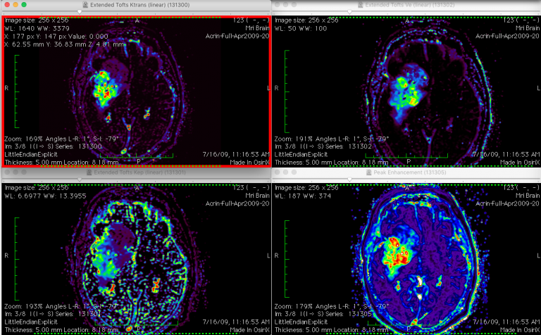 OsiriX DICOM Viewer | Plugins