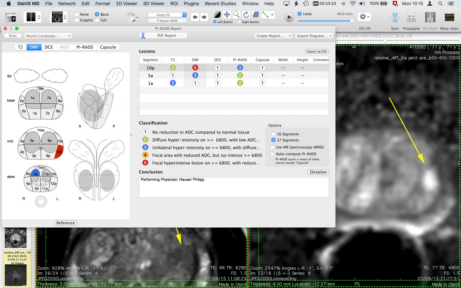 OsiriX DICOM Viewer | Plugins