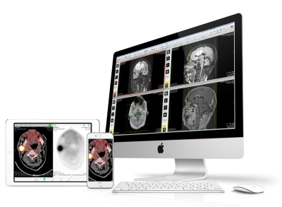 OsiriX DICOM Viewer | The world famous medical imaging viewer