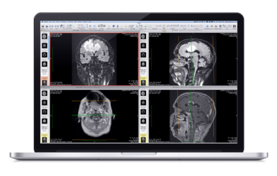 OsiriX DICOM Viewer | OsiriX MD