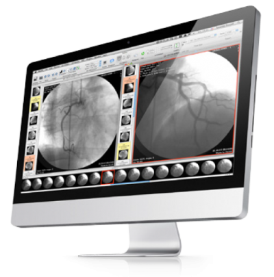 OsiriX DICOM Viewer | OsiriX MD