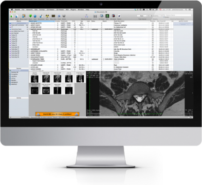 OsiriX DICOM Viewer | OsiriX MD