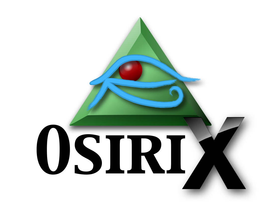 OsiriX DICOM Viewer | The world famous medical imaging viewer